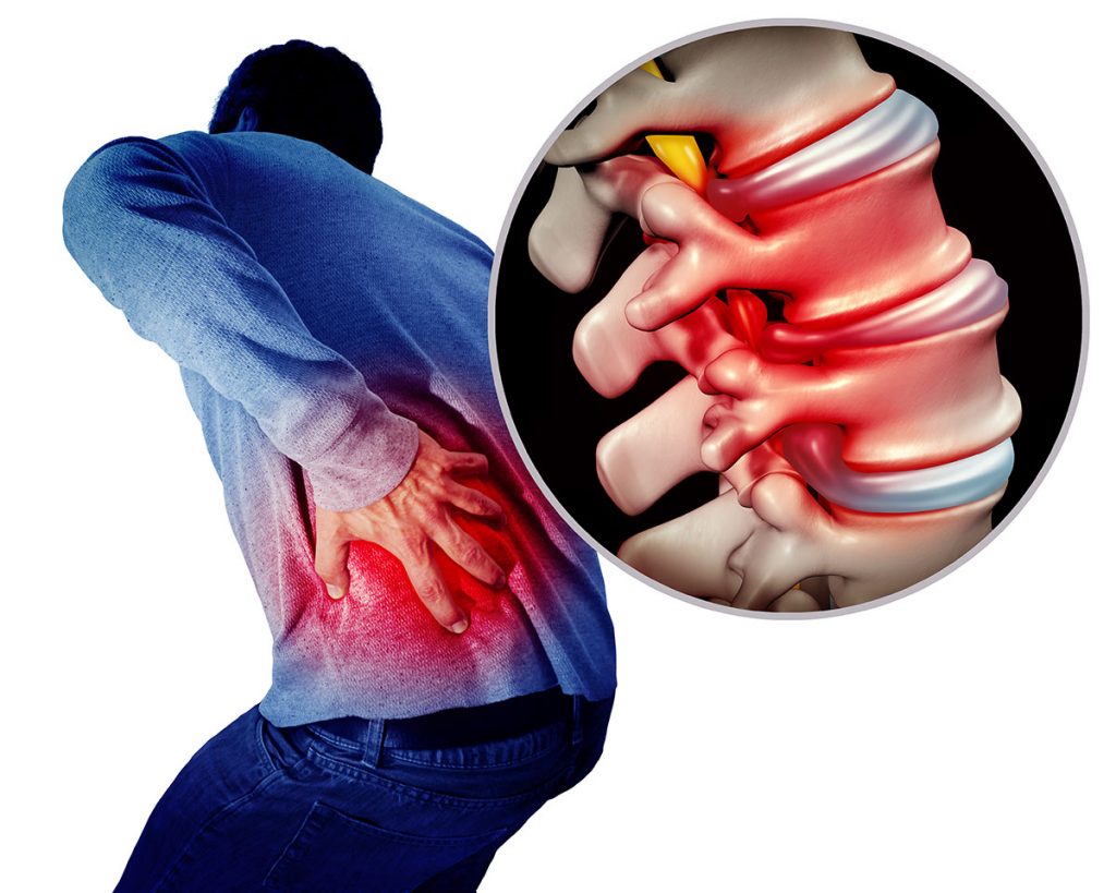 What Is Inflammation? – Body & Soul Chiropractic